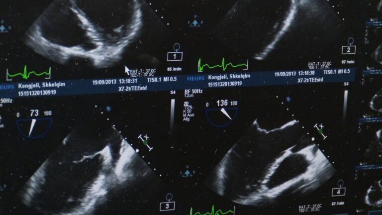 Vasculab Colombia LTDA - Ecodoppler Vascular I Doppler en Bogotá