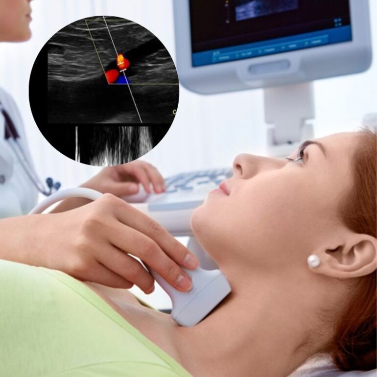 Vasculab Colombia LTDA - Ecodoppler Vascular I Doppler en Bogotá