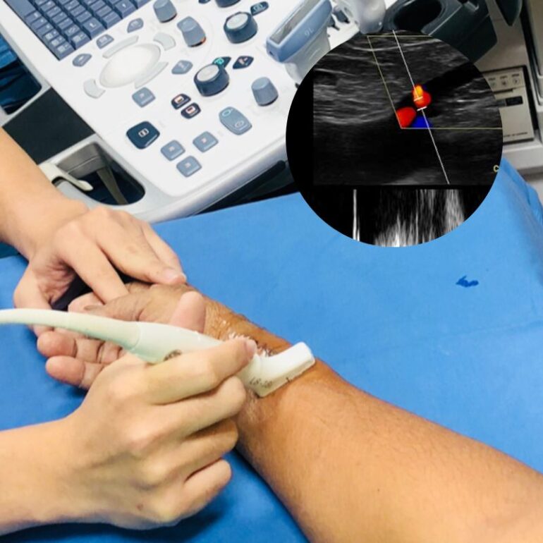 ¿Qué es una Ecografía Doppler Vascular? - Ecodoppler Vascular I Doppler ...