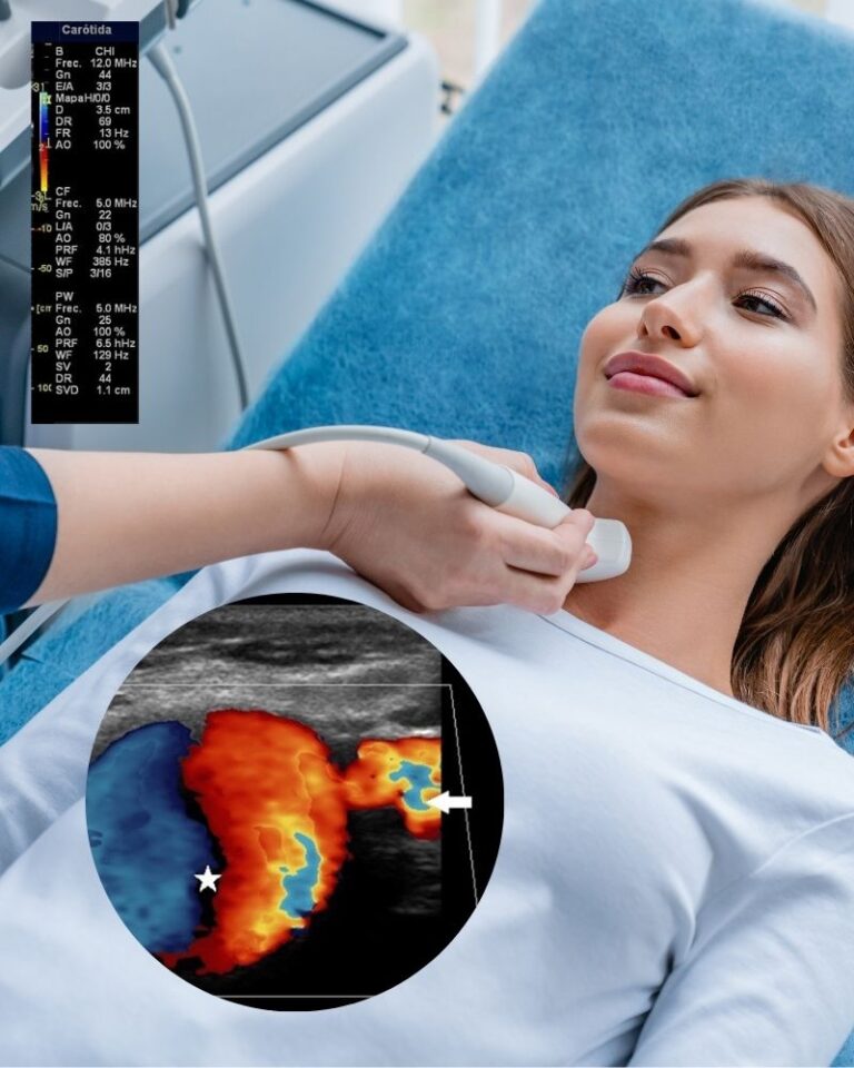 Ecografía Doppler de vasos del cuello - Ecodoppler Vascular