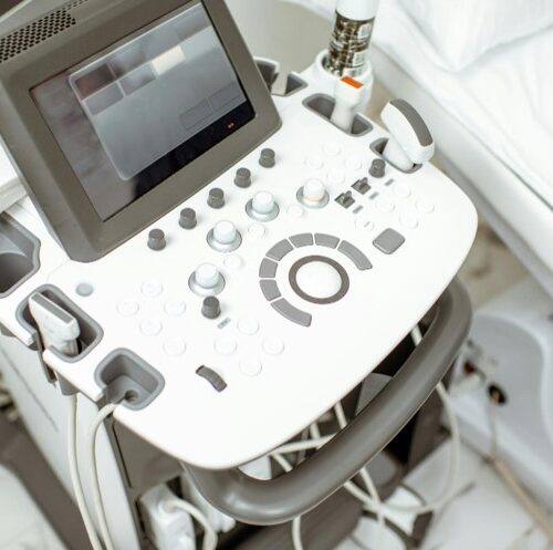 ¿Cómo se hace una ecografía Doppler? | Ecodoppler Vascular