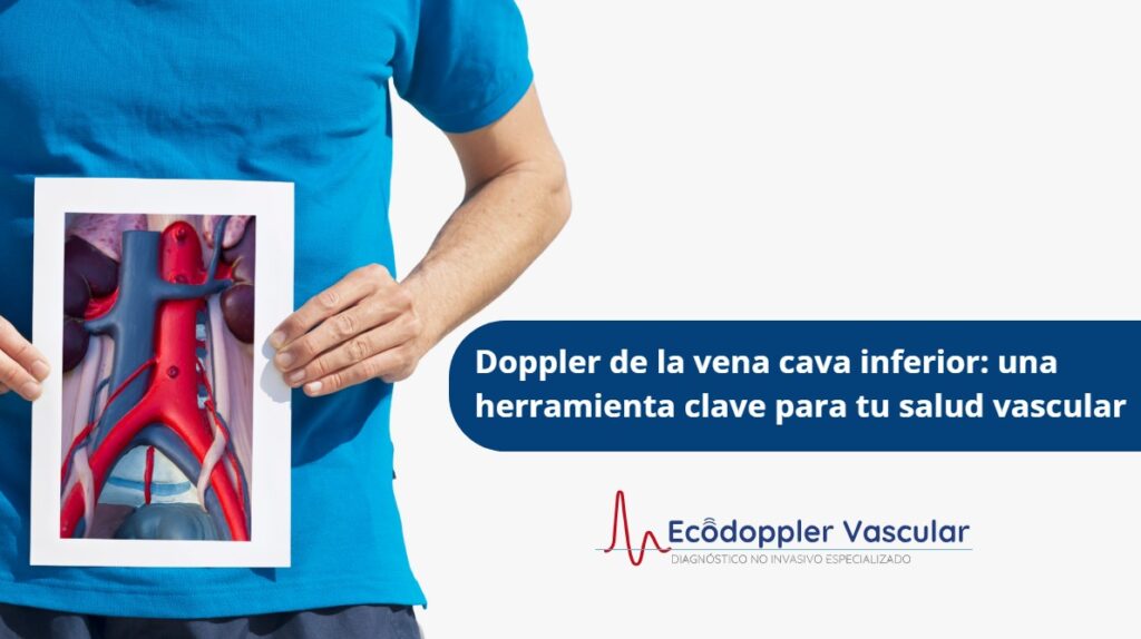Ecografía Doppler:vena cava inferior que es y para qué sirve