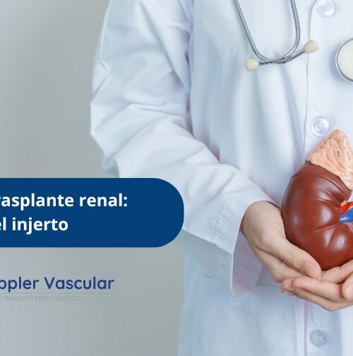 ¿Ecografía dúplex o Doppler? Conoce cuál te conviene